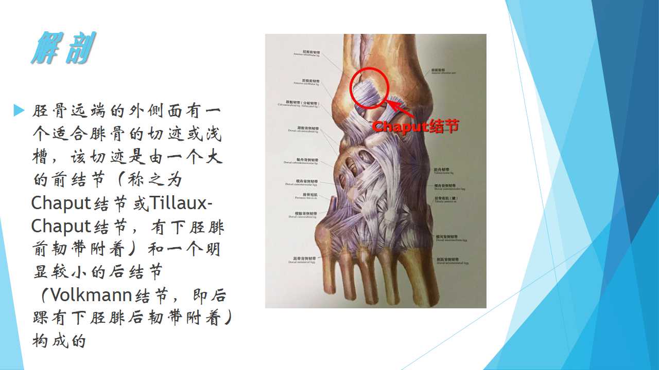 特殊类型的踝关节骨折（六）：Tillaux-Chaput Fracture - 好医术早读文章 - 好医术-赋能医生守护生命