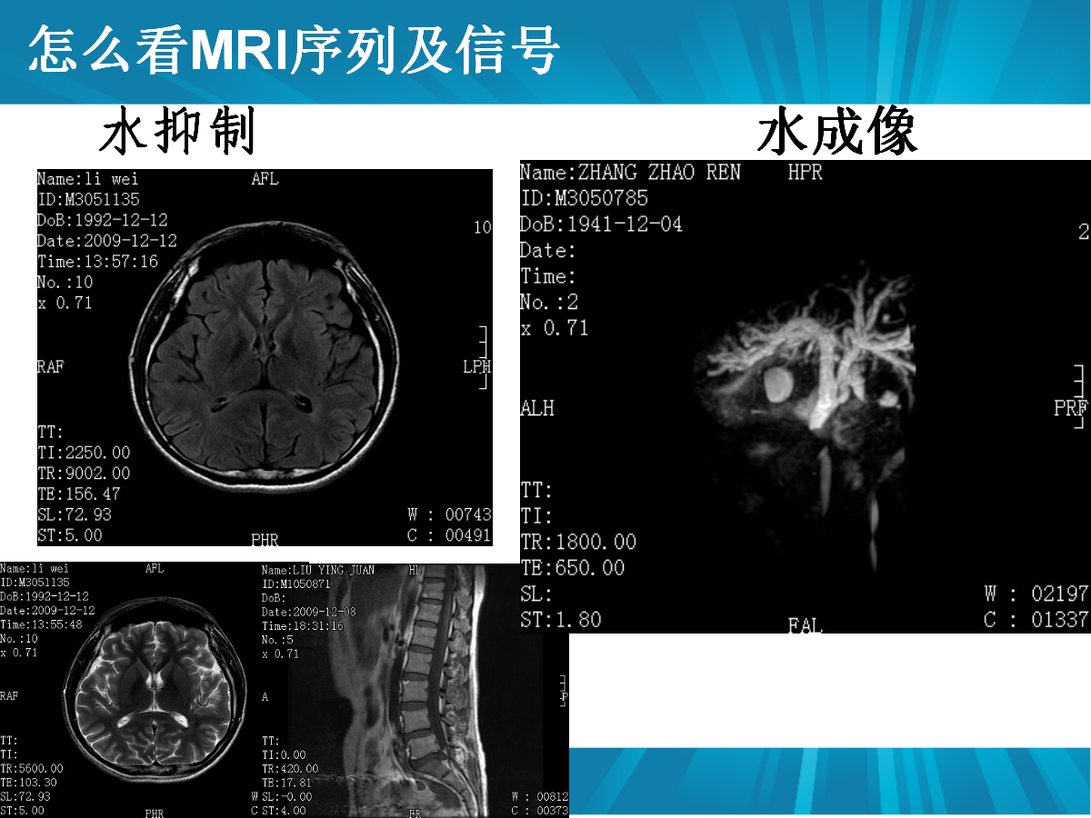 手把手教你如何阅读MRI片，太实用了！ - 好医术早读文章 - 好医术-赋能医生守护生命