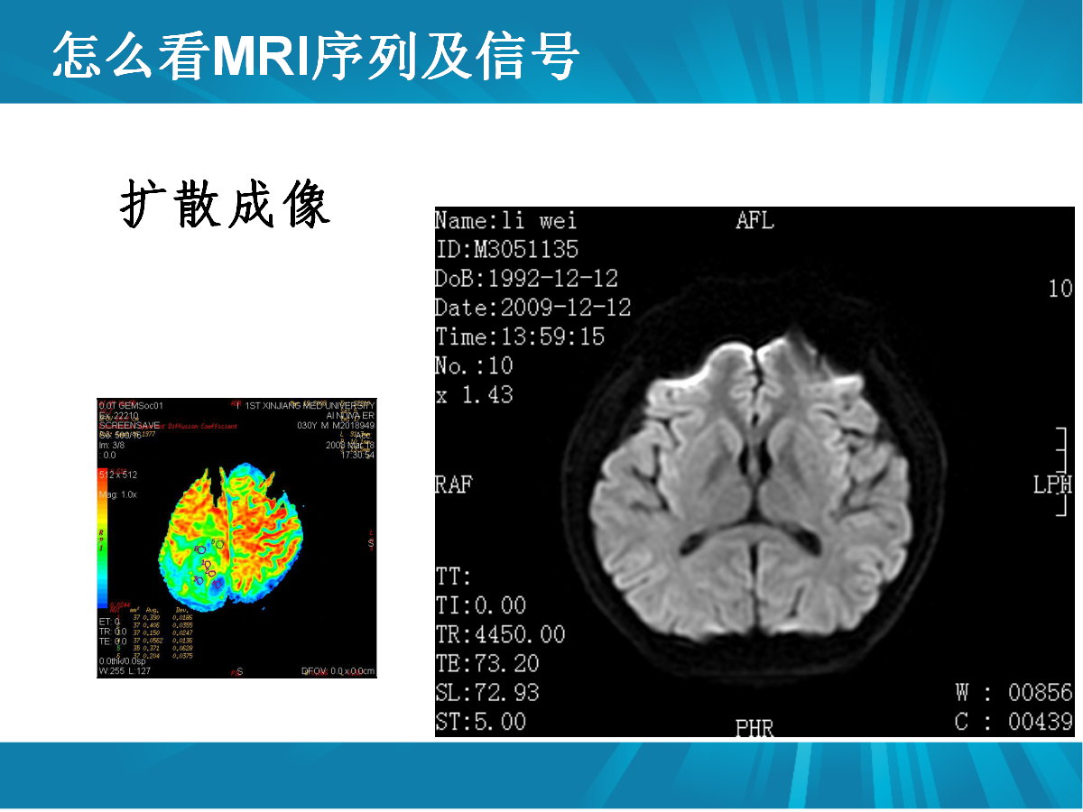 手把手教你如何阅读MRI片，太实用了！ - 好医术早读文章 - 好医术-赋能医生守护生命