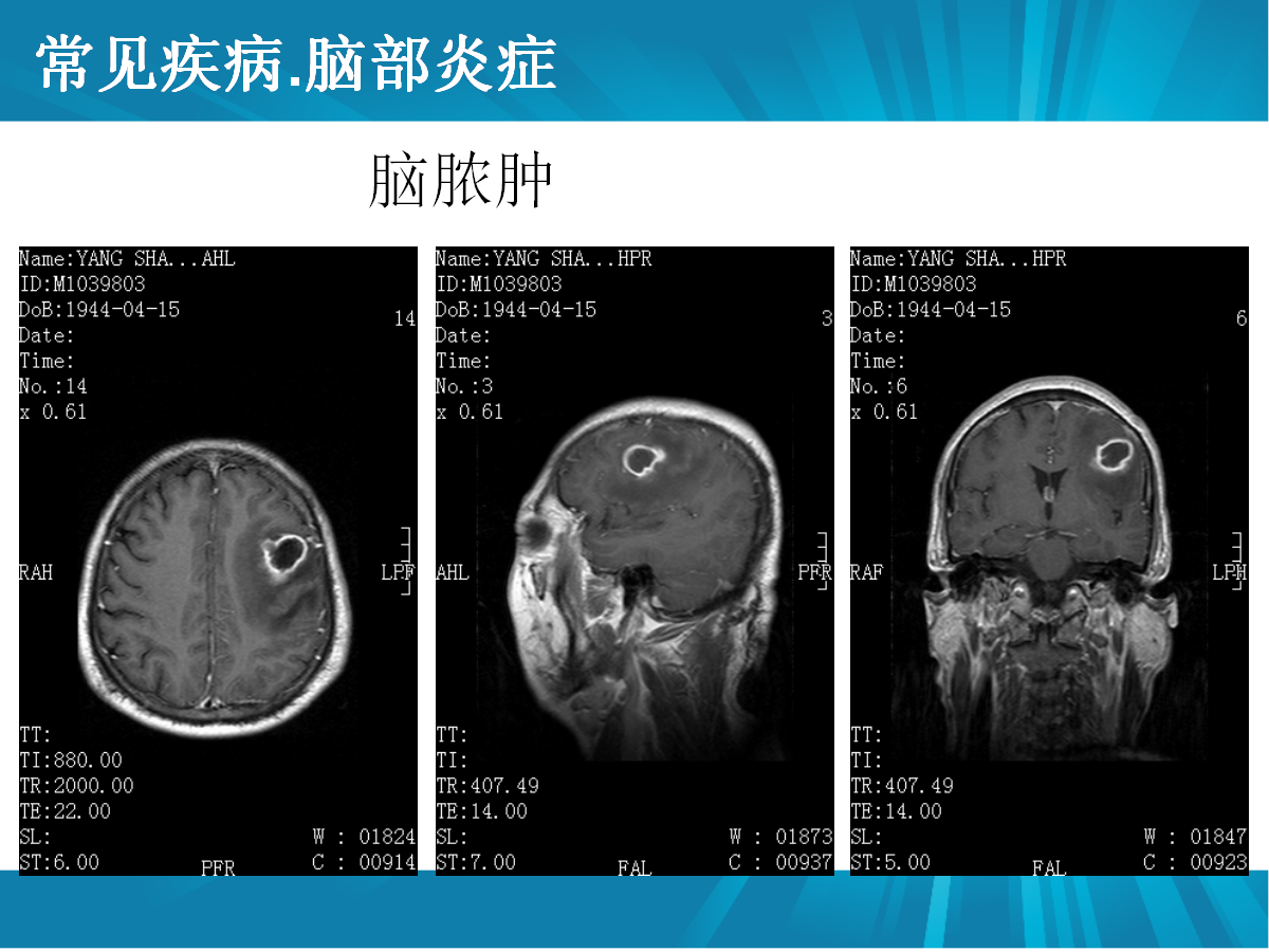 手把手教你如何阅读MRI片，太实用了！ - 好医术早读文章 - 好医术-赋能医生守护生命