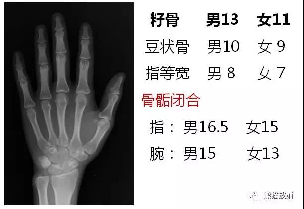 值得收藏的骨龄图谱!方便随时对照! 好医术早读文章 好医术 赋能医生守护生命